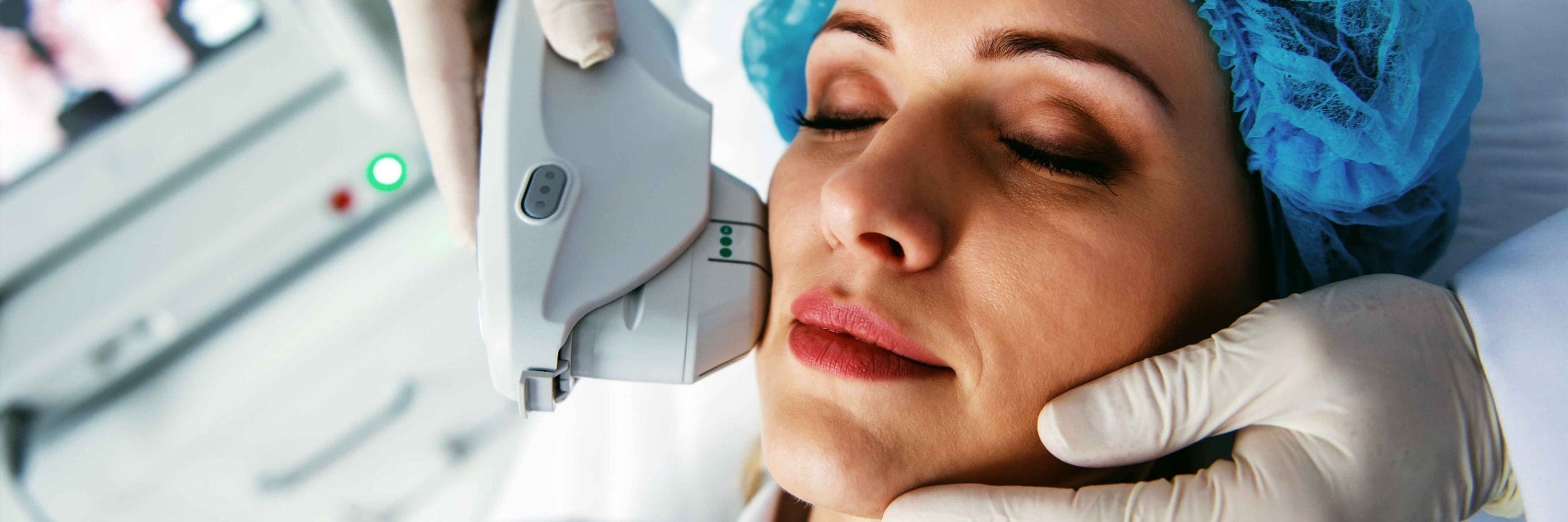 Hyperpigmentation laser toning - Skin & Medical Northbridge